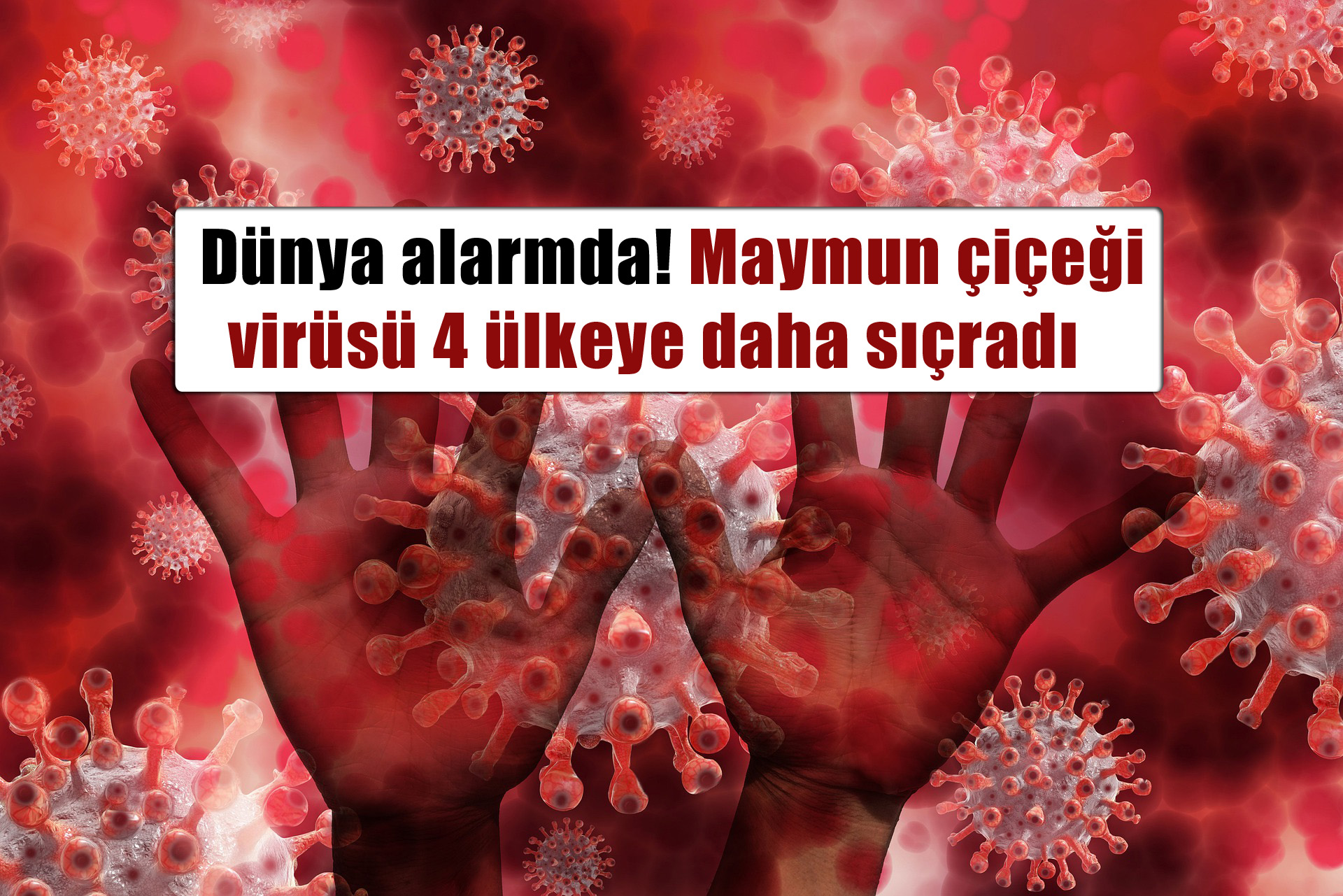 Maymun çiçeği virüsü 4 ülkeye daha sıçradı - Turizm Avrupa